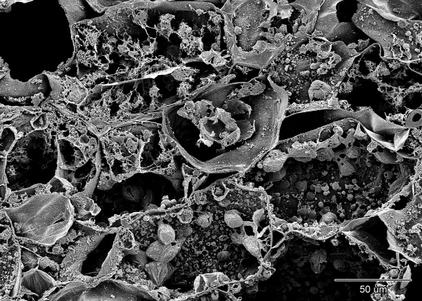 Microscopy Innovations | Scanning electron microscopy (SEM) and 3D ...