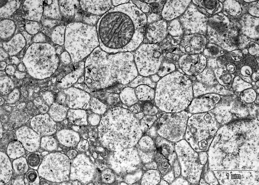 Microscopy Innovations | Transmission electron microscopy (TEM)