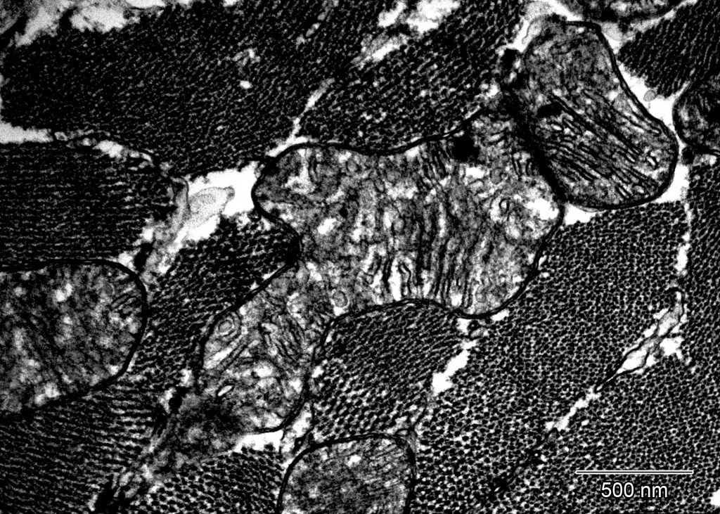 Microscopy Innovations | Transmission electron microscopy (TEM)