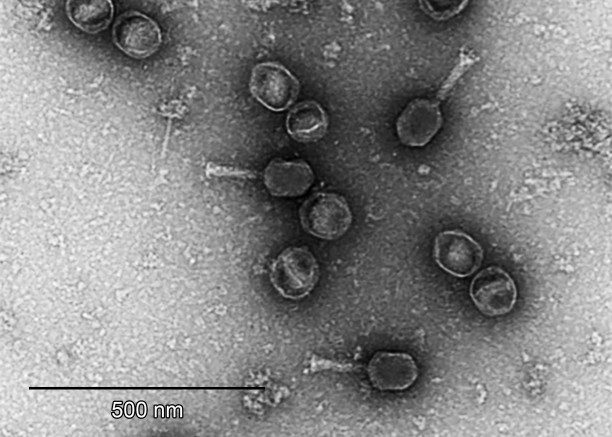 Microscopy Innovations | Preparing viruses on TEM grids