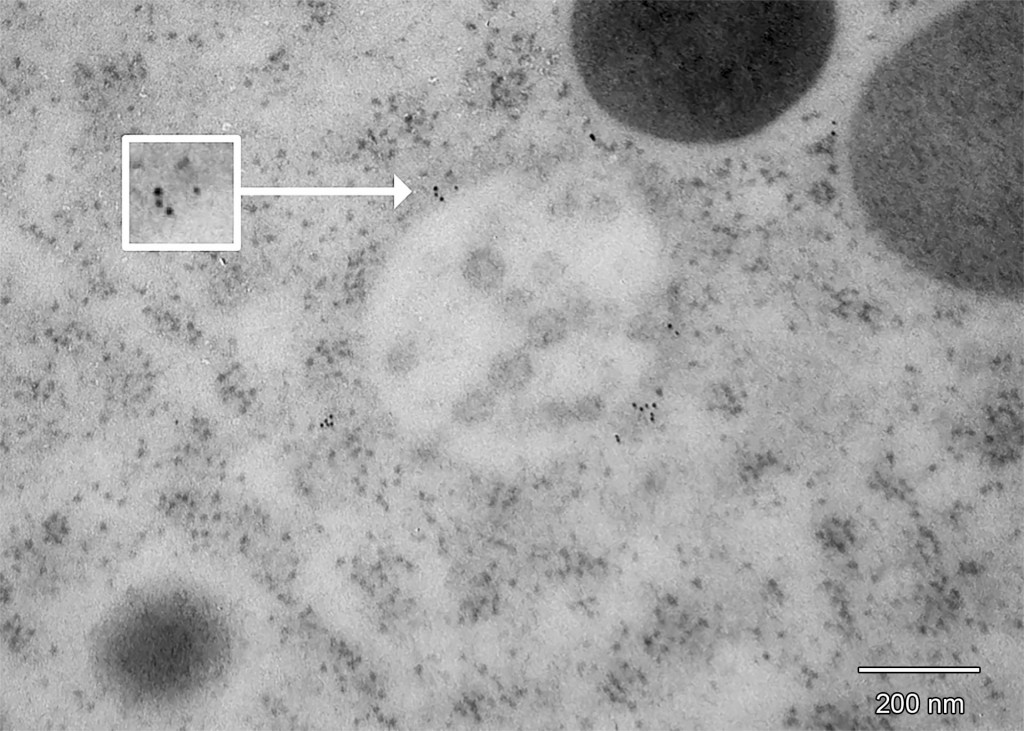 Microscopy Innovations | On Grid Immunogold labeling (IGL)
