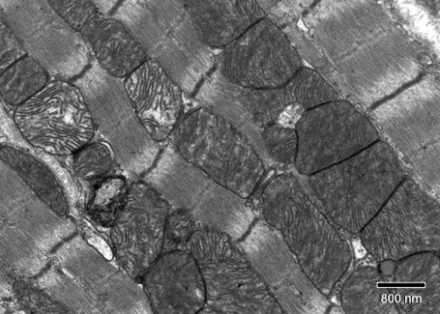 Microscopy Innovations | Transmission electron microscopy (TEM)