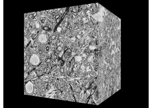 Microscopy Innovations | Scanning electron microscopy (SEM) and 3D ...