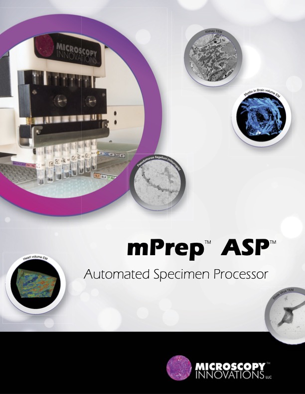Microscopy Innovations | mPrep™ ASP™ Automated Specimen Processors